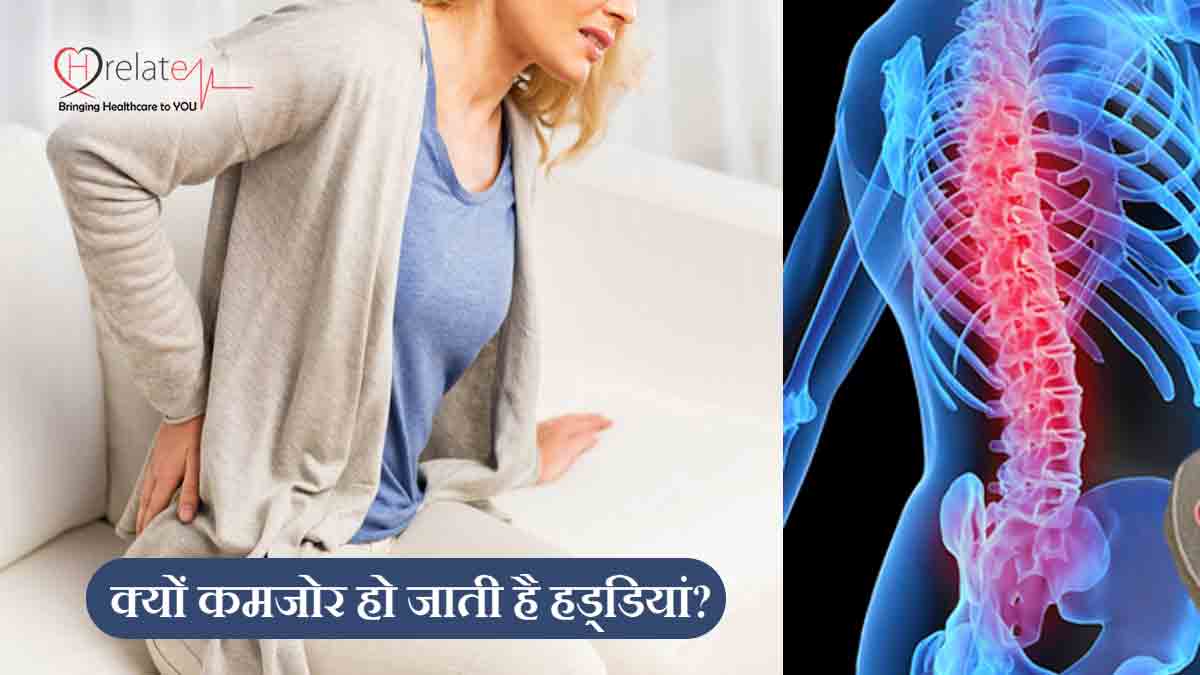 Haddi Kamjor Hone Ke Karan Haddi Kamjor Hone Ke Karan